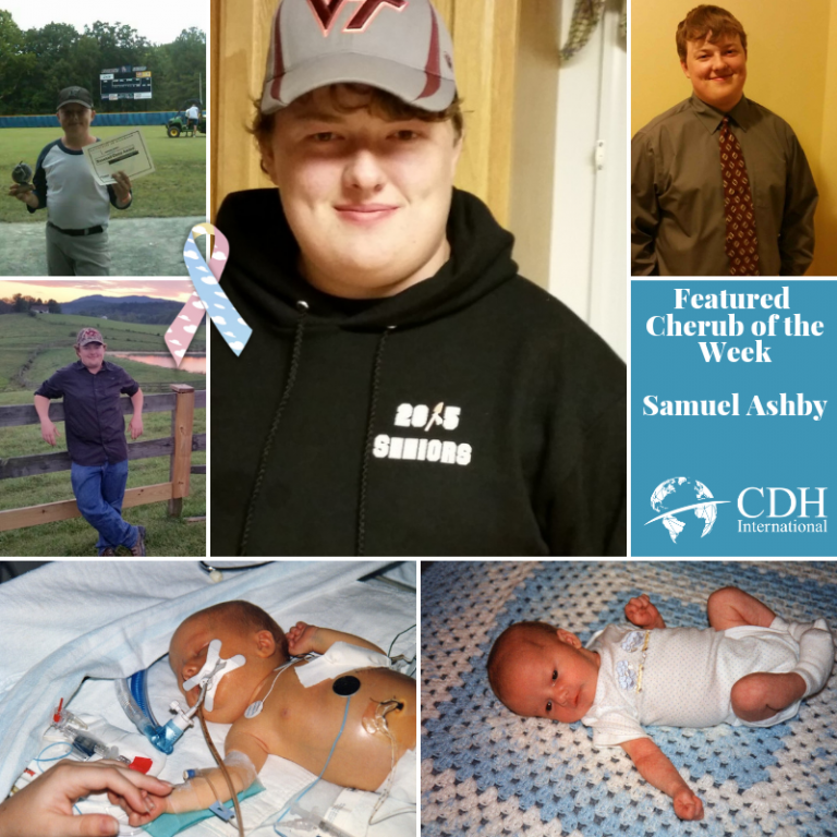 CDH International - A Global Initiative to Stop Congenital ...