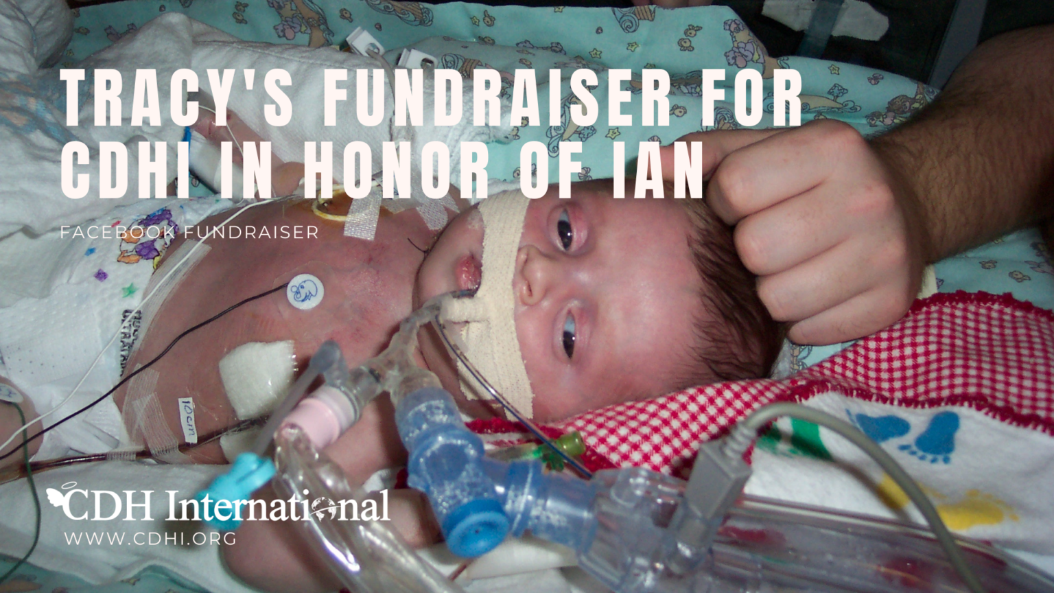 CDH International - A Global Initiative to Stop Congenital ...