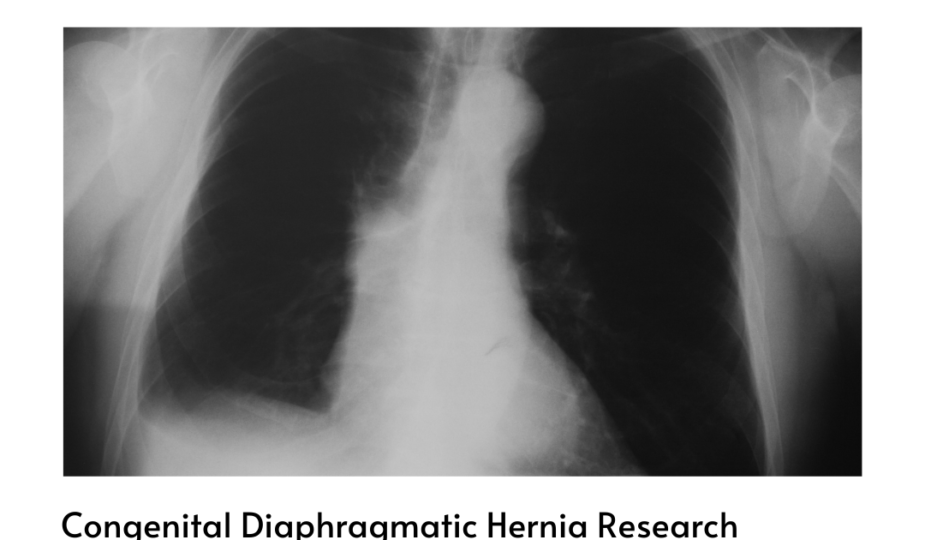 - Research: Longitudinal Follow-Up With Radiologic Screening for ...