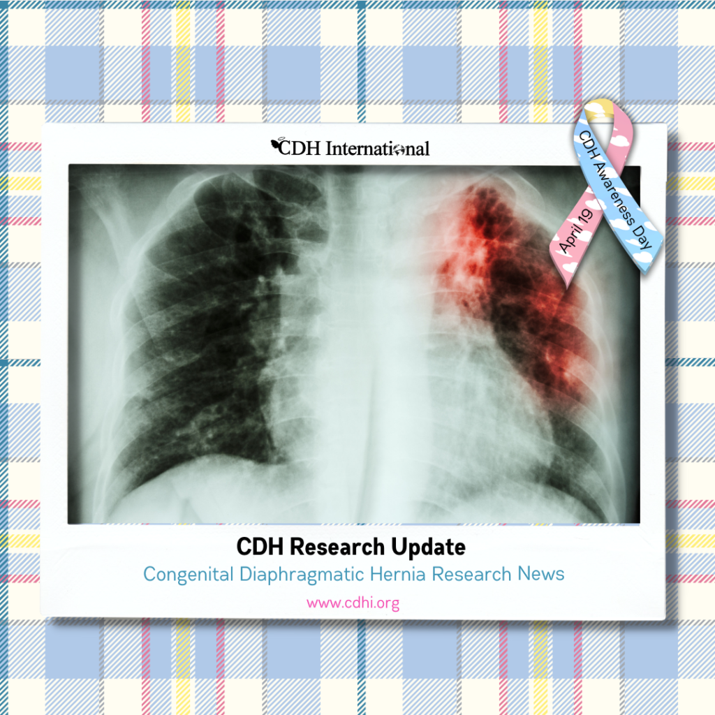 CDH Research International - Research: Echocardiographic Assessment of ...