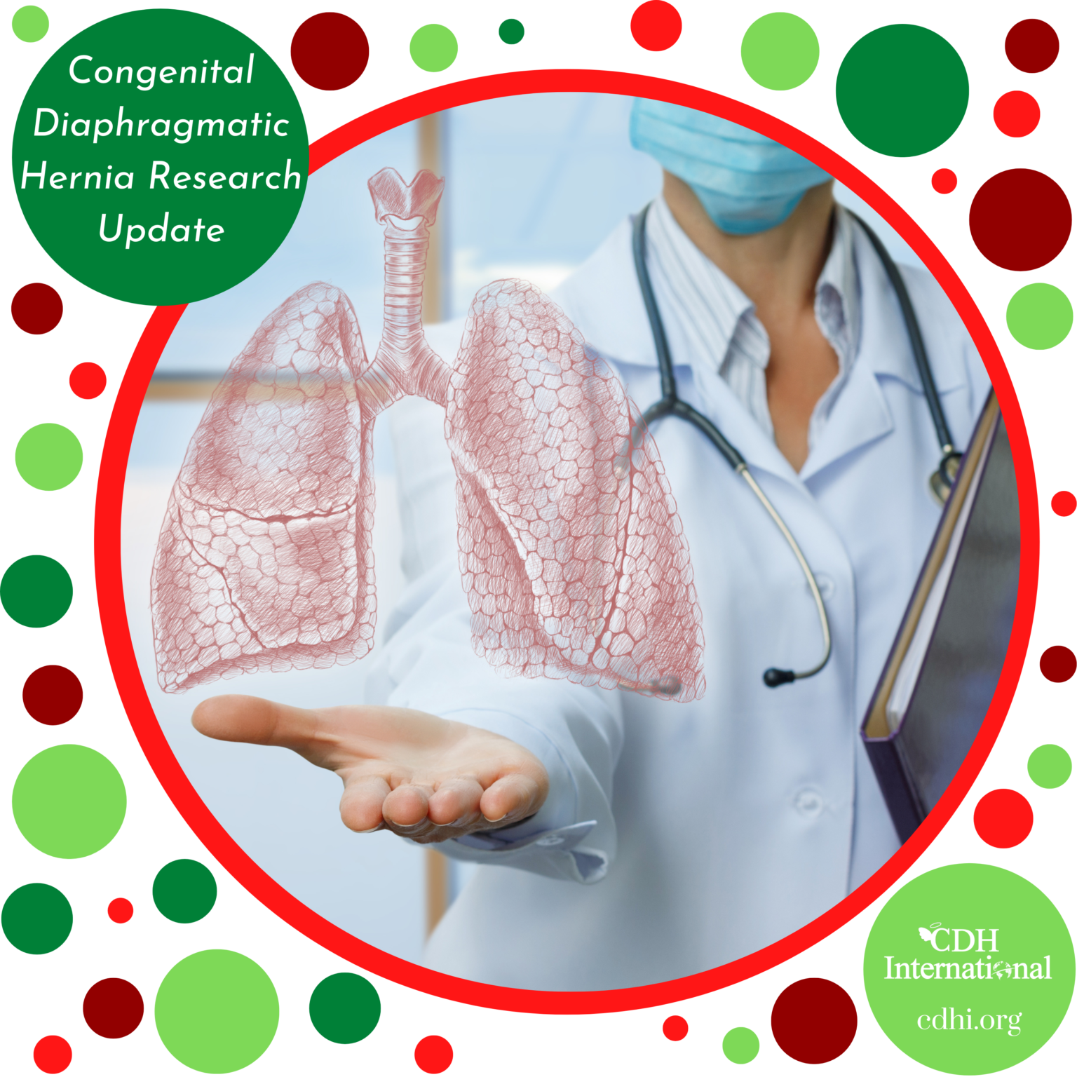 CDH International - A Global Initiative to Stop Congenital ...