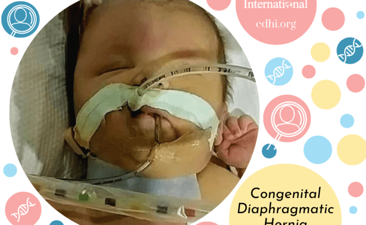 CDH International - A Global Initiative to Stop Congenital ...