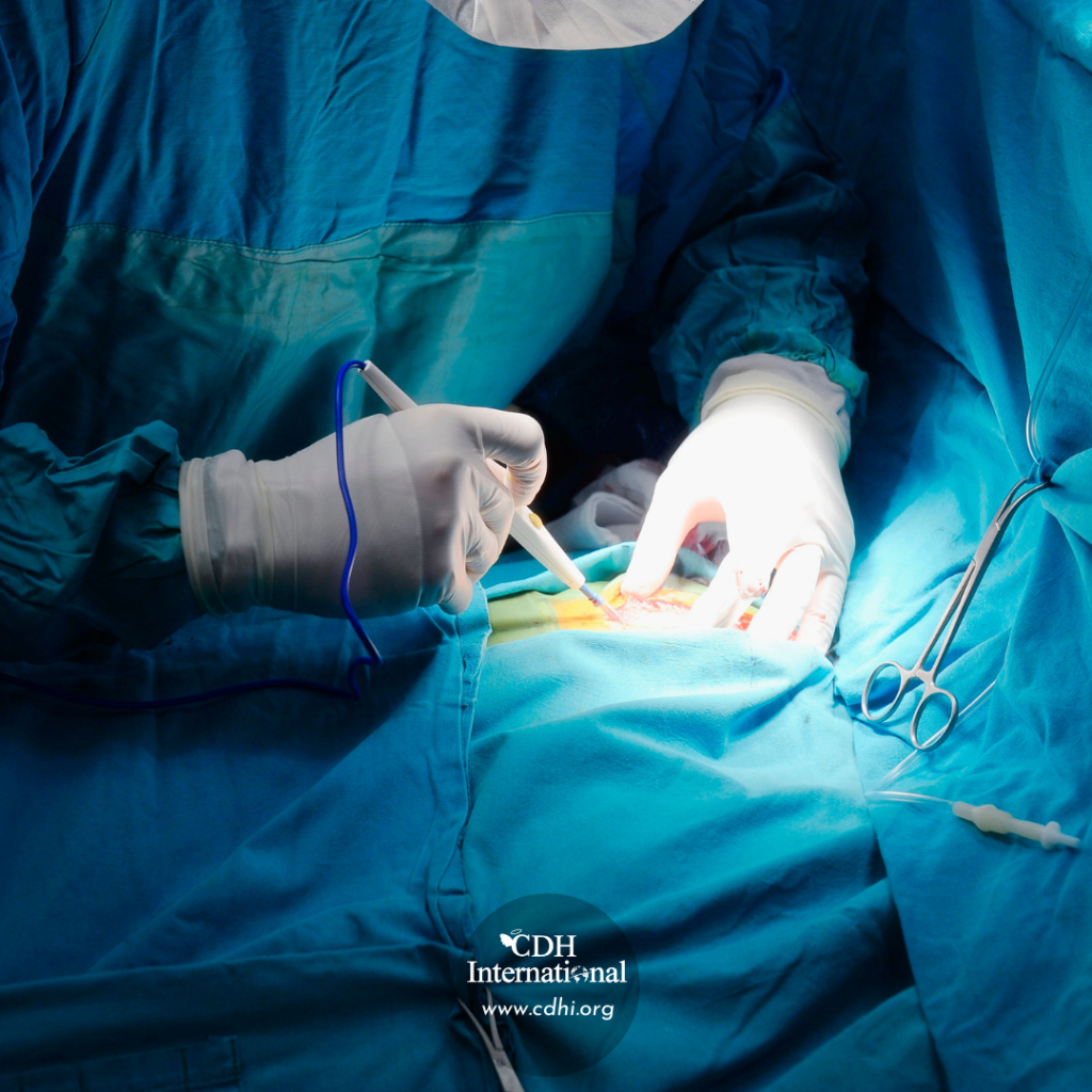 CDH Research International - A Global Initiative to Stop Congenital ...