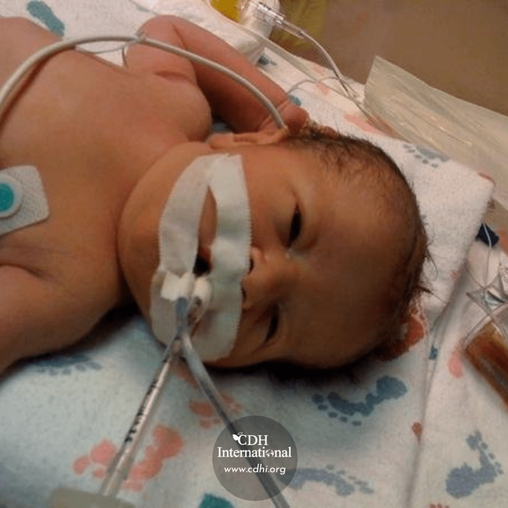 CDH International - A Global Initiative to Stop Congenital ...