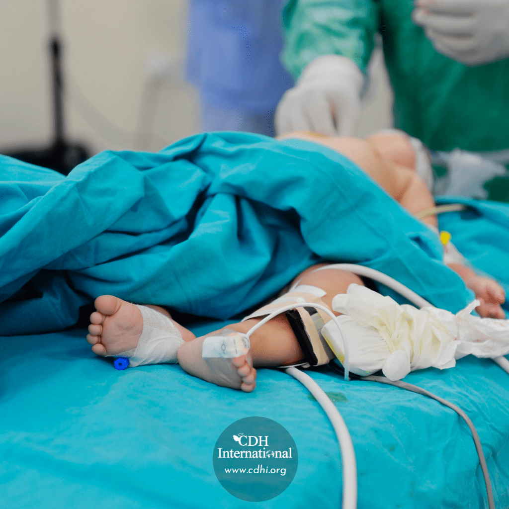 CDH Research International - Research: Left atrial strain in neonates ...